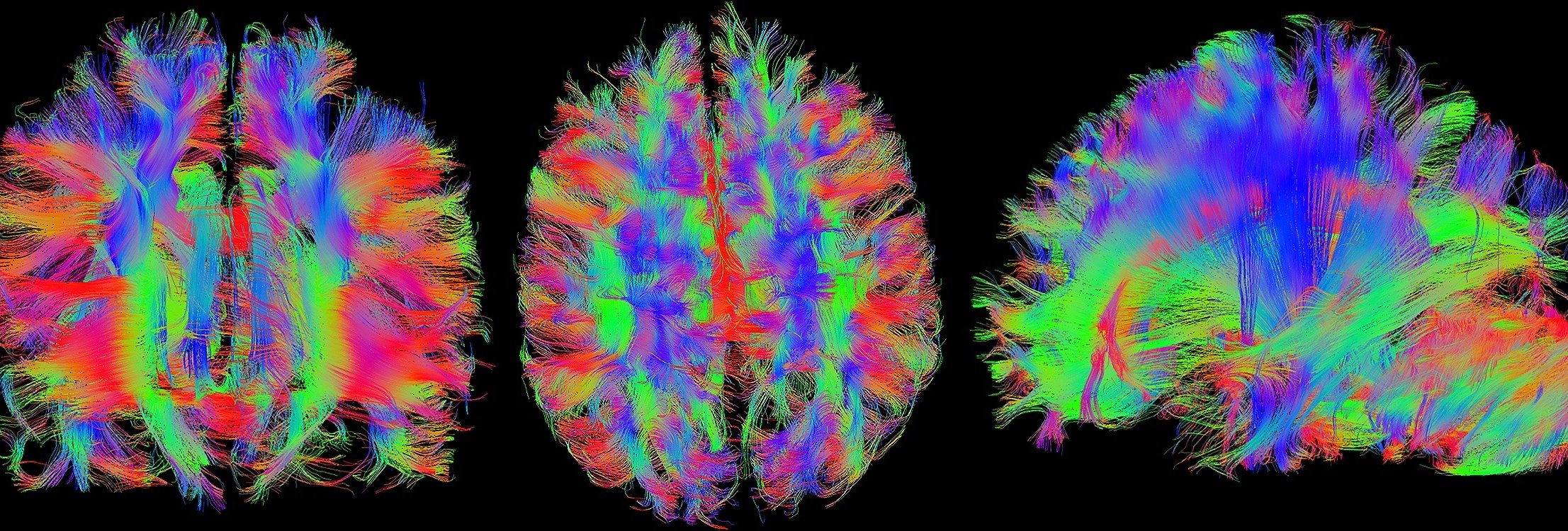 Why We Should Pay Attention to Brain Research - Association of Partners ...